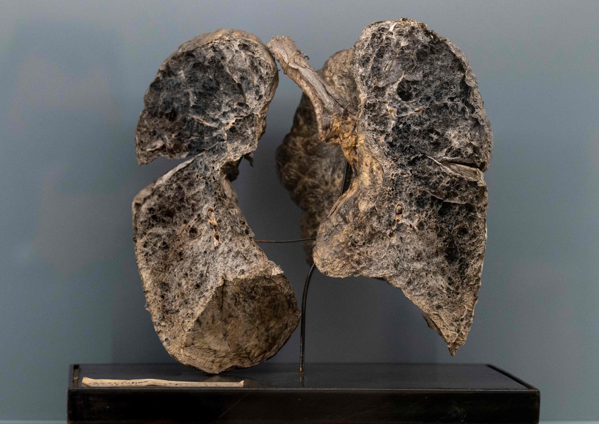 How a natural history museum showing human remains, including of a ...
