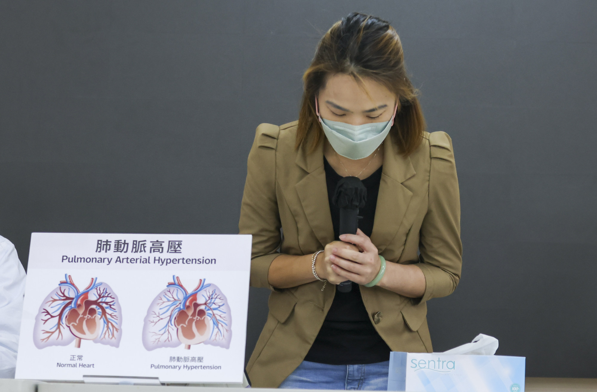 Hong Kong doctors issue urgent appeal for lung donation to save woman’s ...