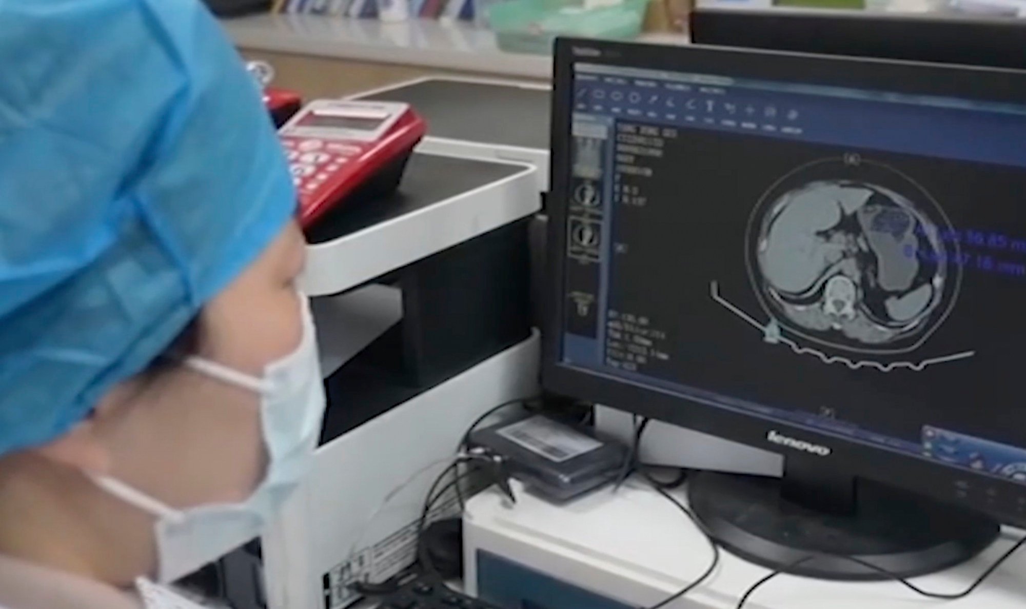 ‘Drink cola’: doctor in China tells man to consume 2 big bottles of ...