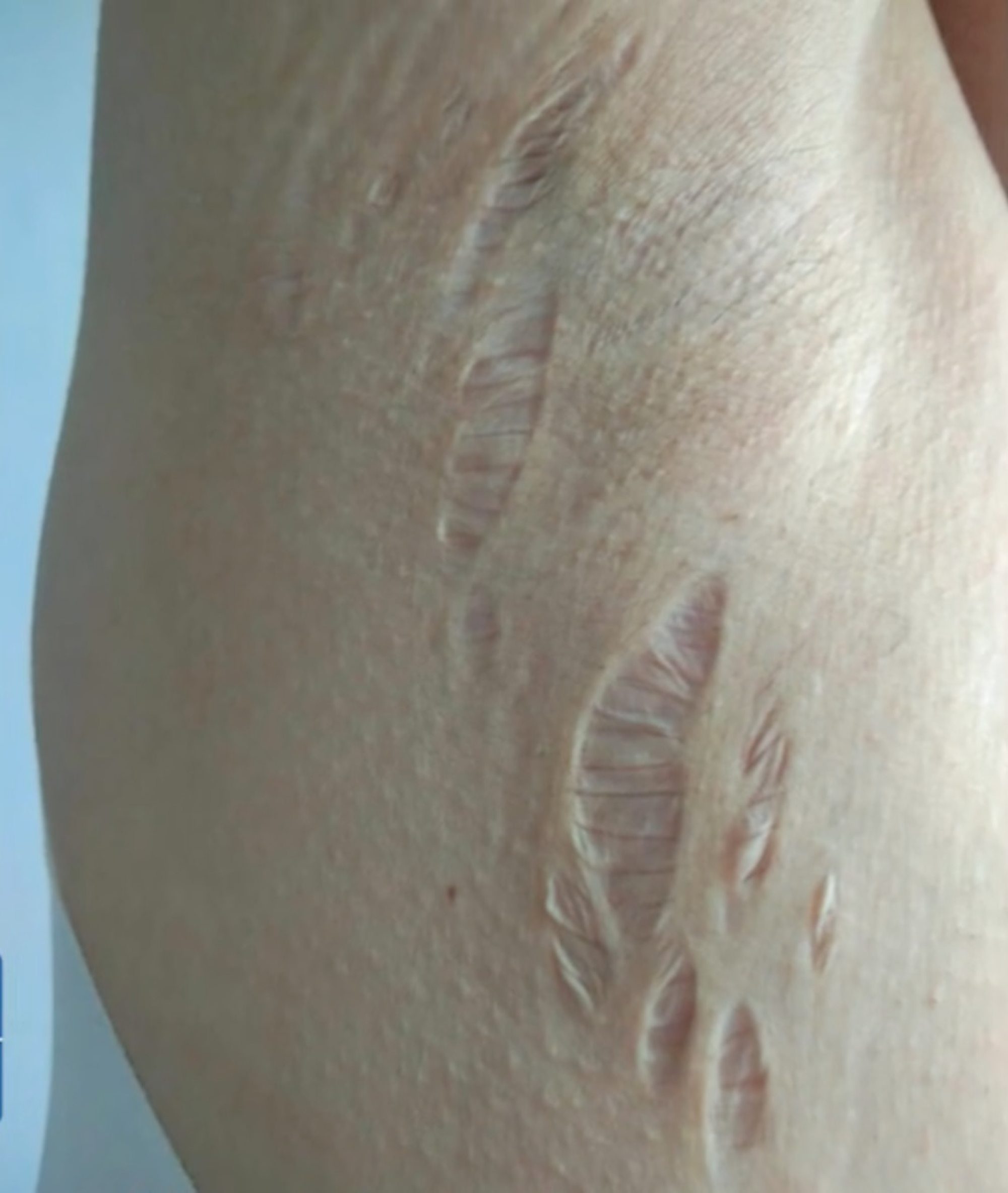 ‘He has destroyed my life’: Chinese doctor who claims her physician ex ...