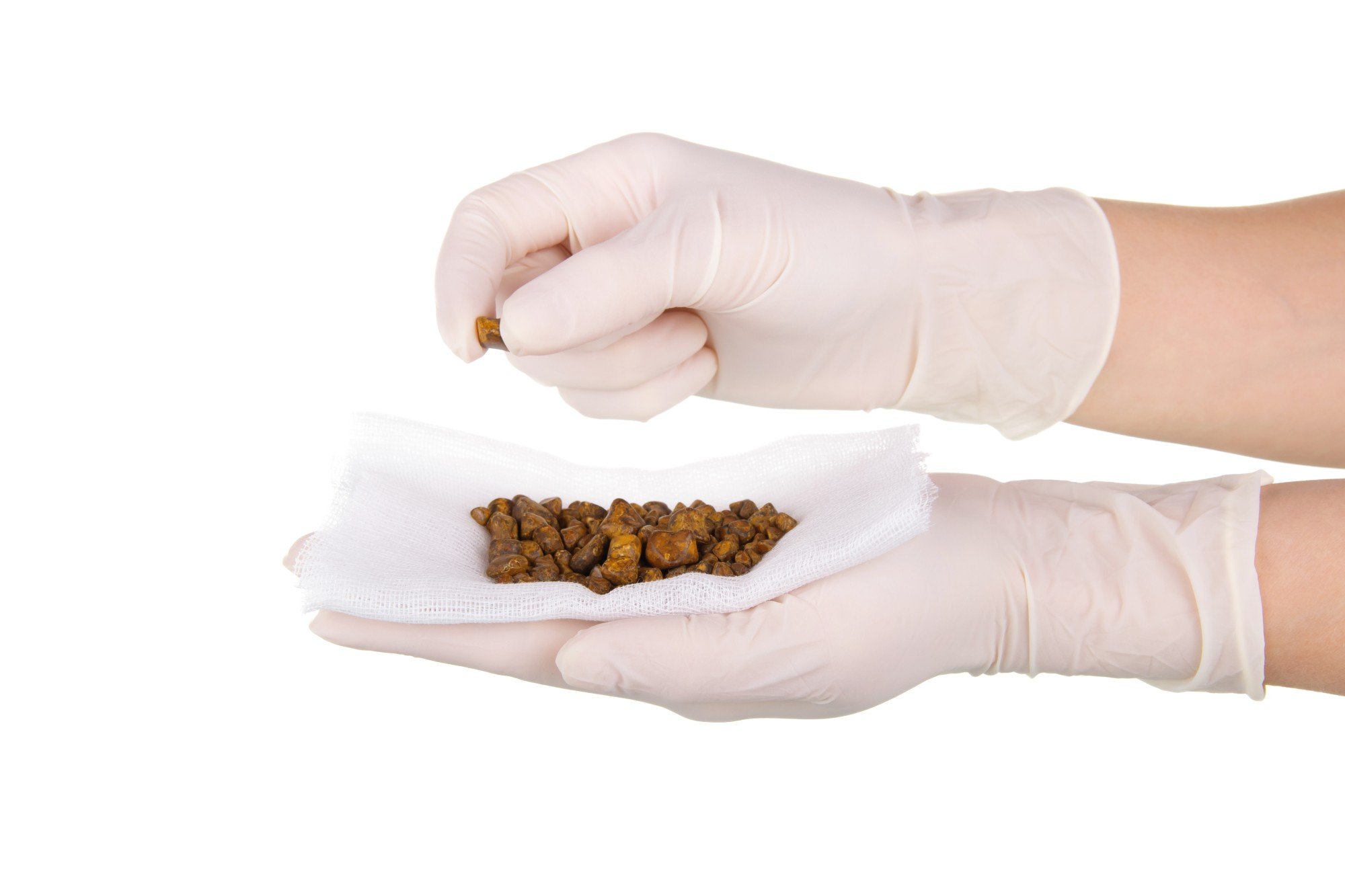 How the gallbladder helps break down fat, why singer Pink lost hers ...