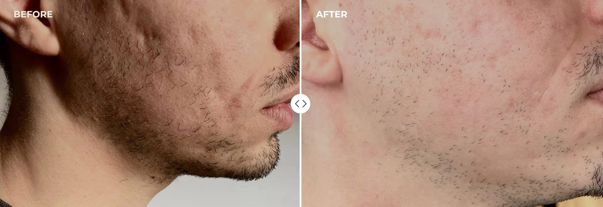 4 luxury at-home beauty gadgets that are transforming skincare, from an ...