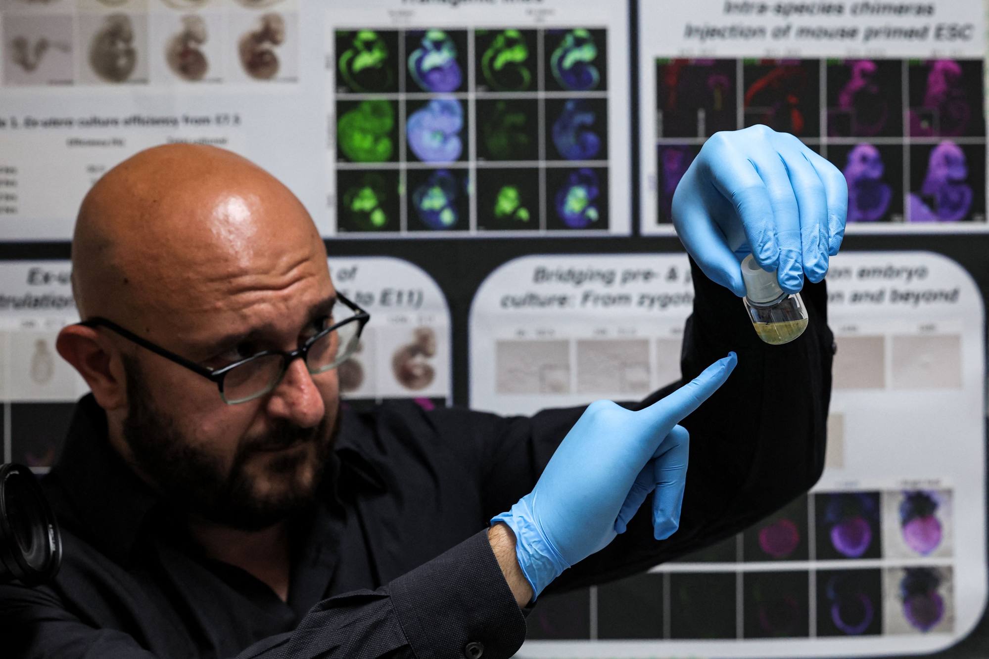 Scientists create human embryo models without sperm or egg | South ...