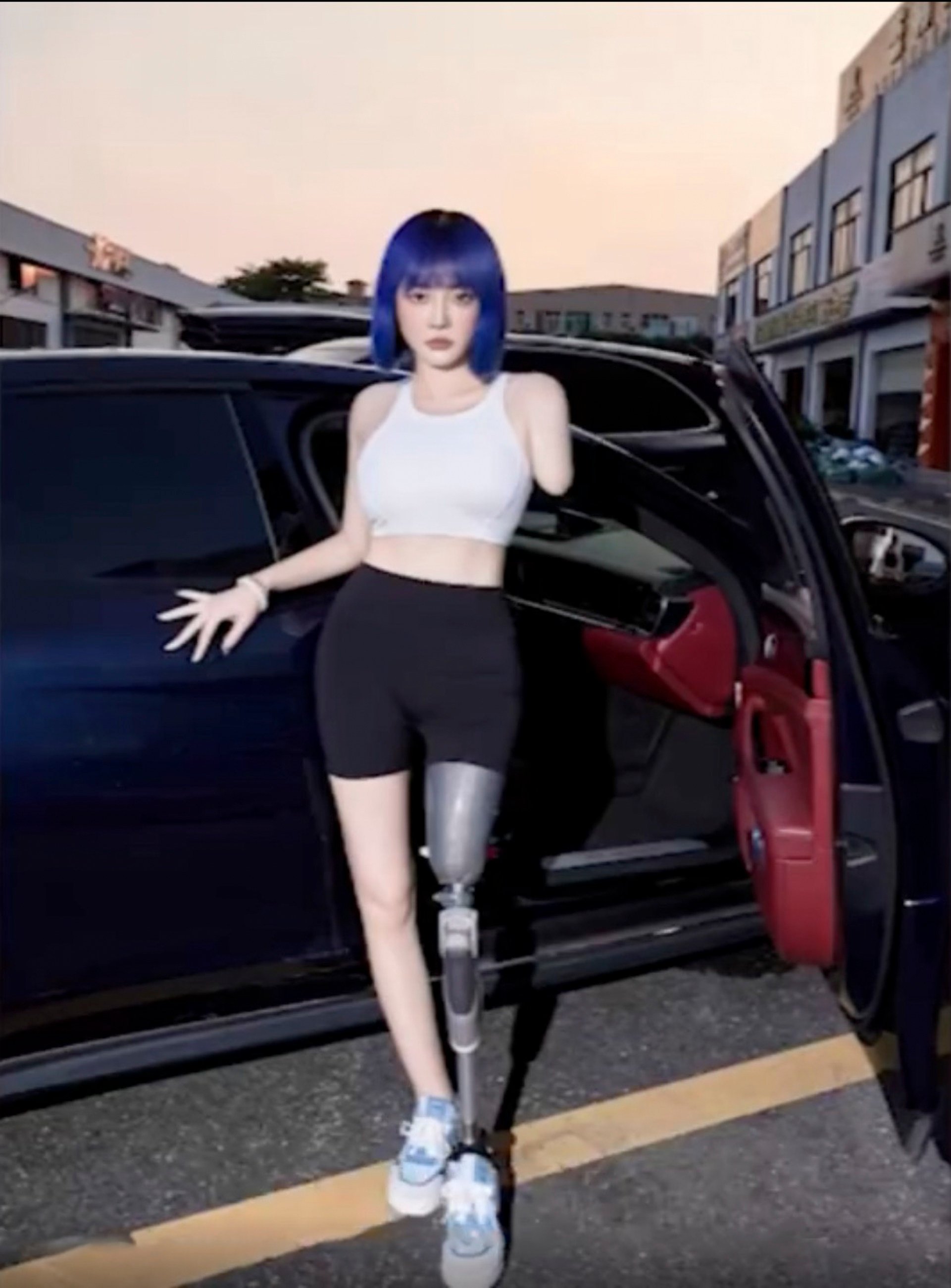 ‘I’m out of your league’: woman in China who lost limbs in car crash ...