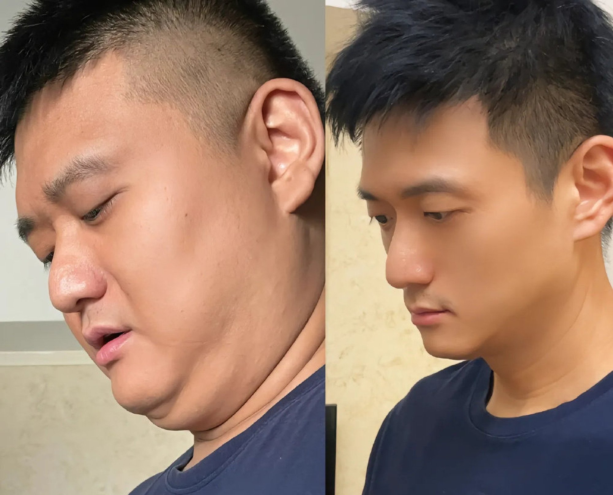‘20 years younger’: man in China motivated to shed 50kg after seeing ...