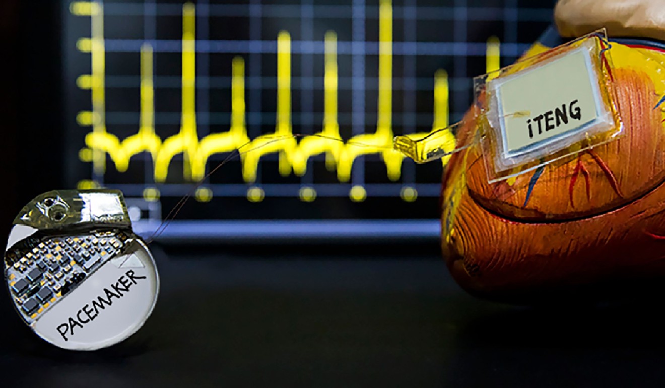 Chinese and US scientists unveil battery-free pacemaker powered by the ...