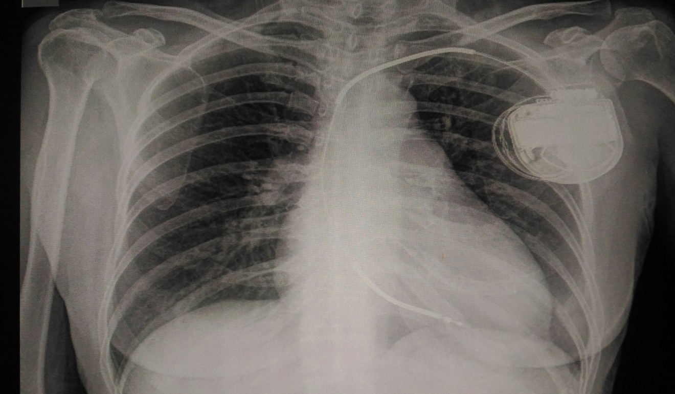 Opinion: Recycled pacemakers, sales of a mind-bending drug and disco ...