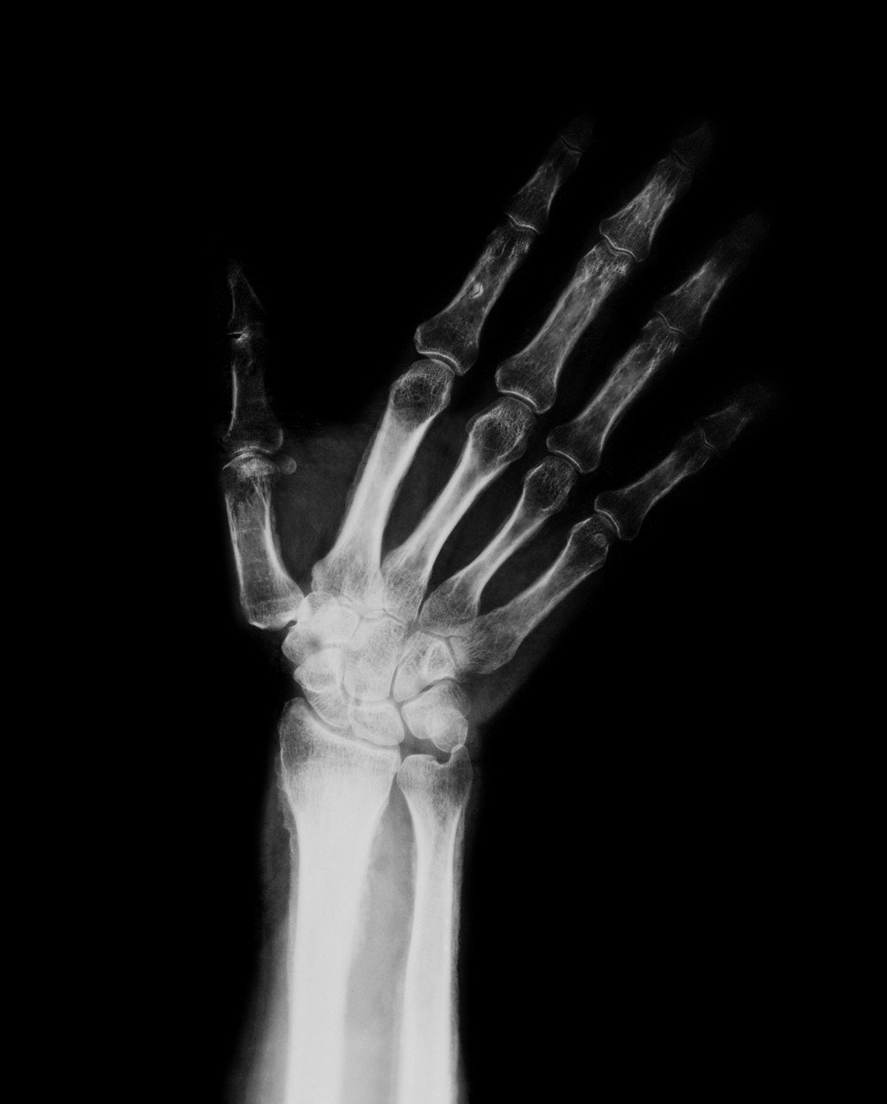 How do human hands differ from animals'? | South China Morning Post