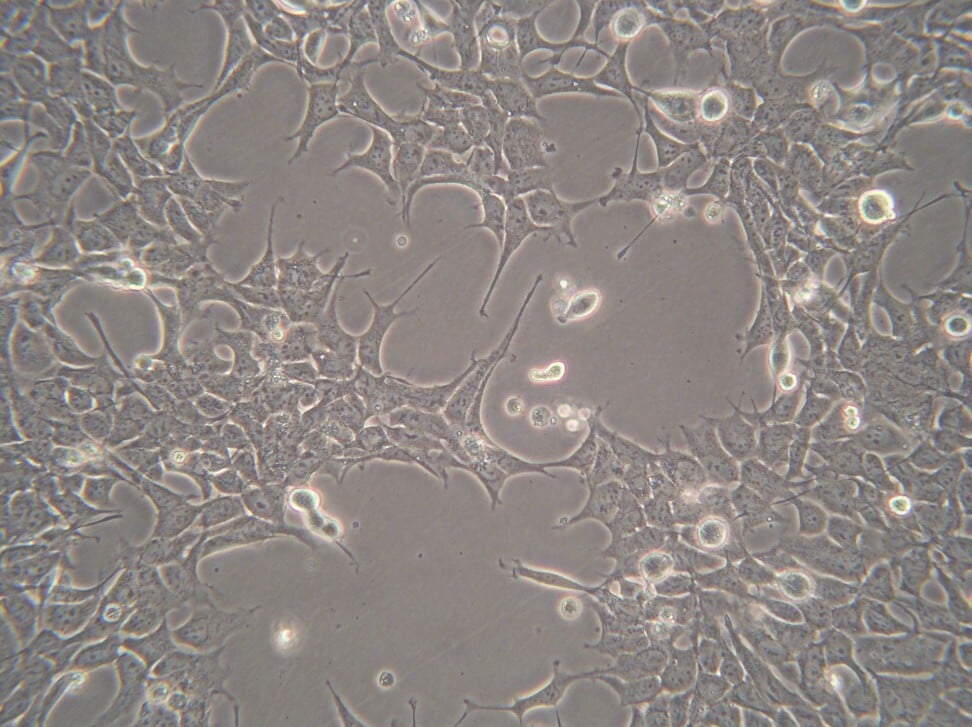 Cells from aborted fetus used for Trump’s Covid-19 treatment reignite ...