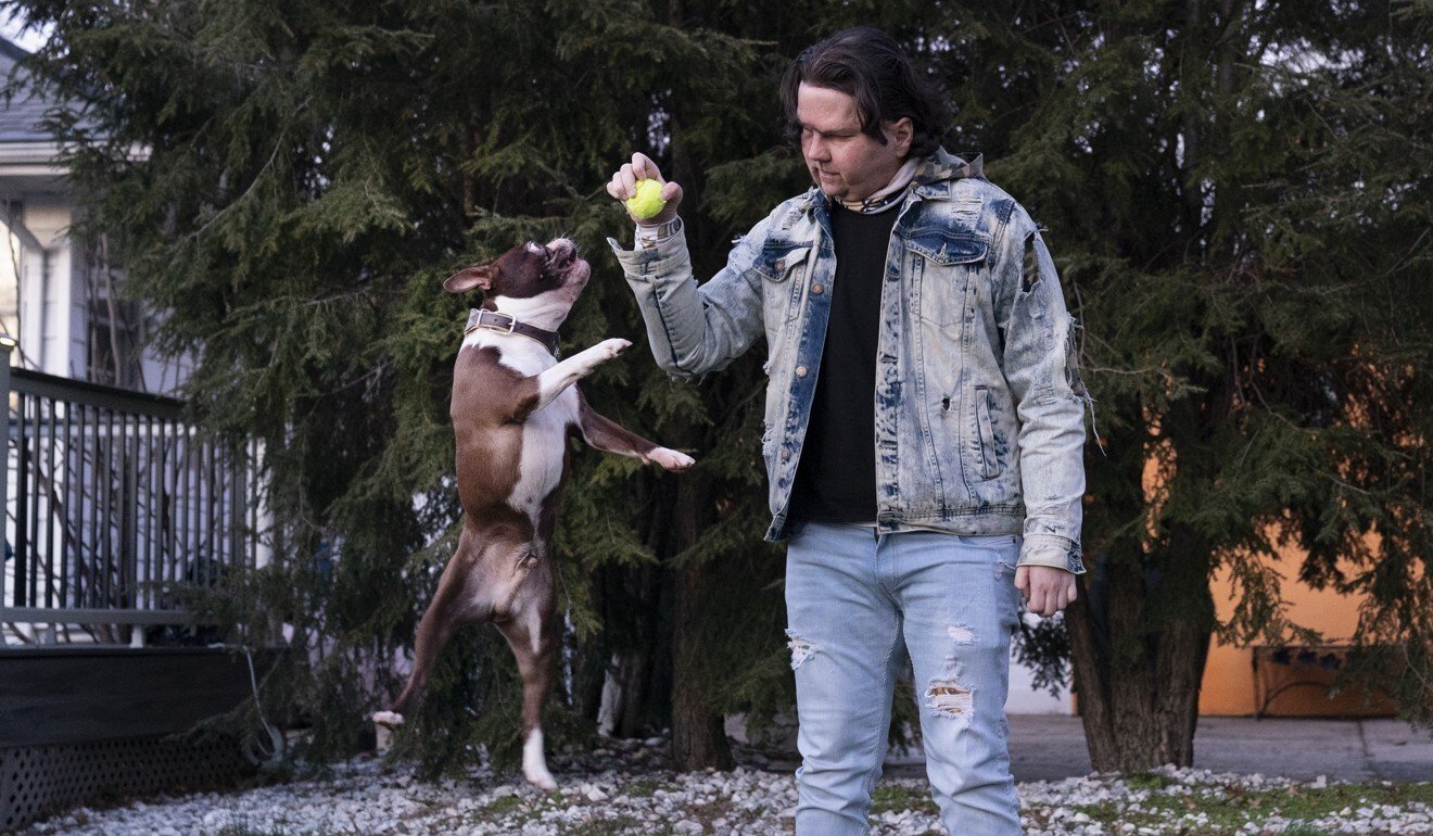 US accident victim gets world’s first double hand and face transplant ...