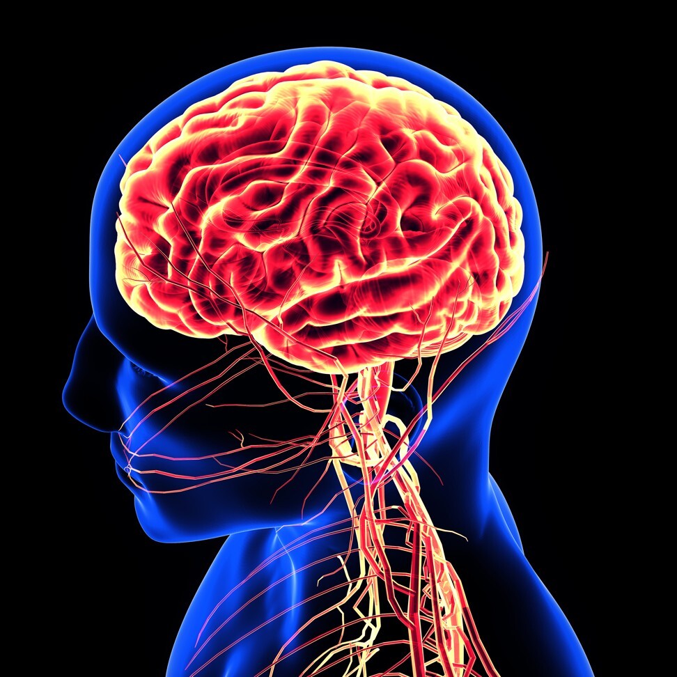 Real-life Inception: why ‘neuro-rights’ laws to protect people’s brains ...