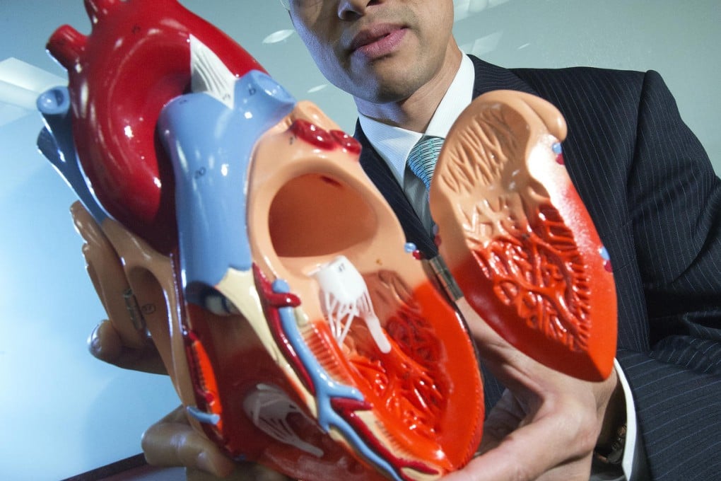 Sudden cardiac arrest: tracking a silent killer | South China Morning Post