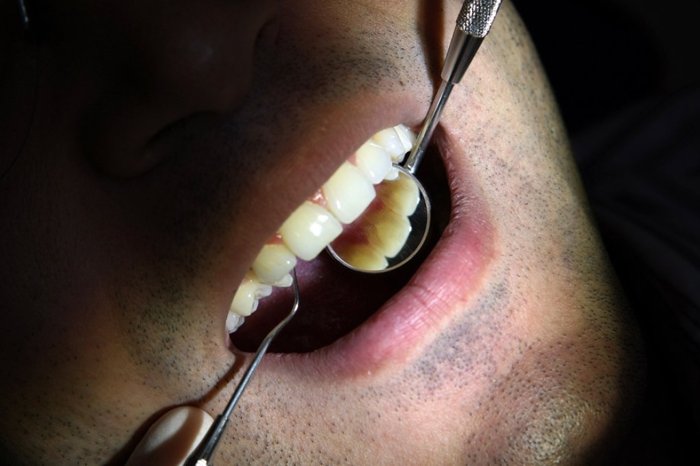 Mussel ‘glue’ could stop sensitivity in teeth | South China Morning Post