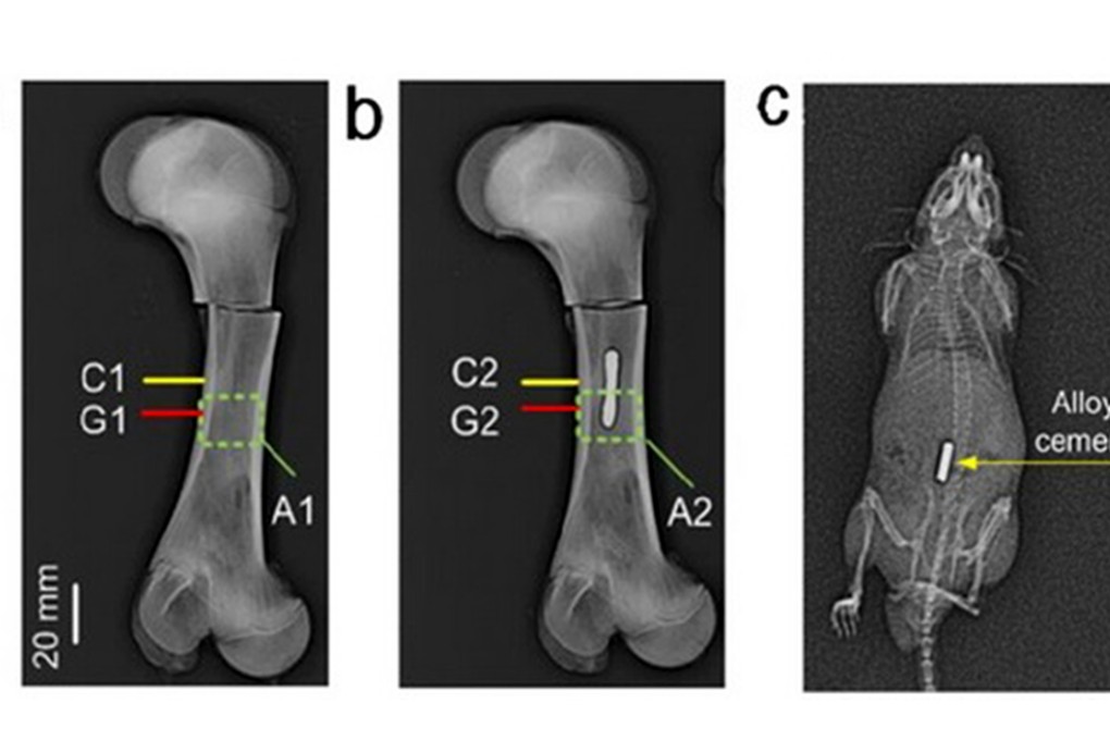how do x rays detect broken bones