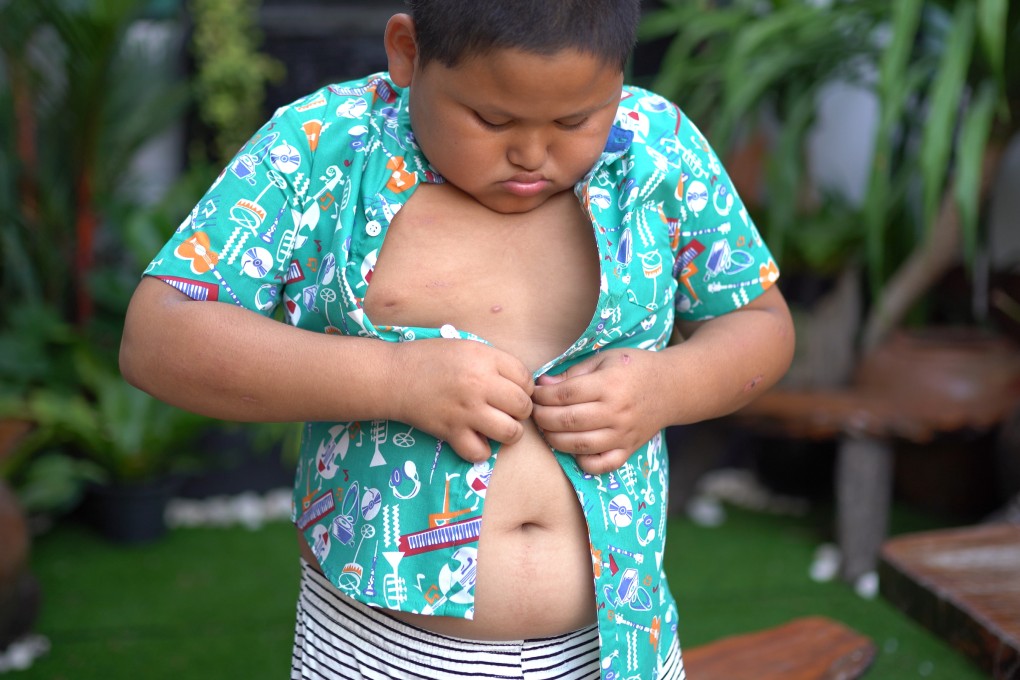 overweight child exercise