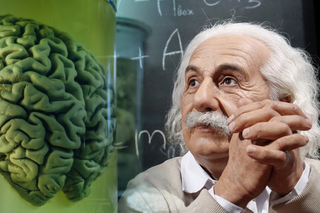 Brain Albert Einsteins Uncommon Features Of Einstein's Brain Might