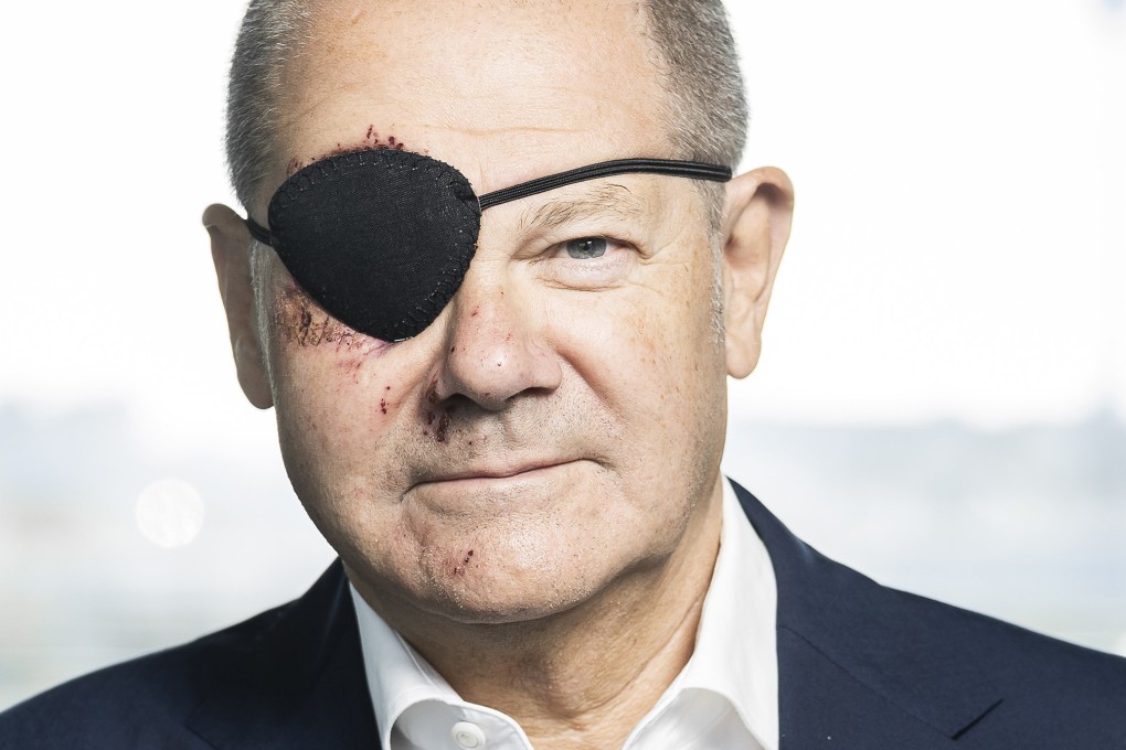 German Chancellor Olaf Scholz tweets picture of himself with black eye ...
