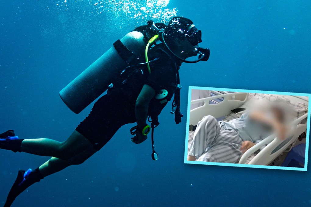 No heartbeat for 4 minutes: thrill-seeking China diver wakes from month ...