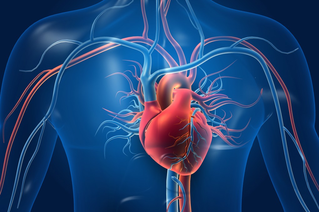 chinese heart attack