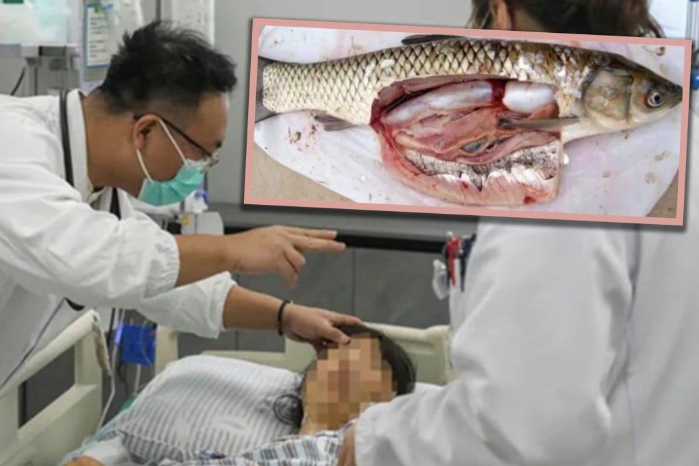 fish good for gallbladder