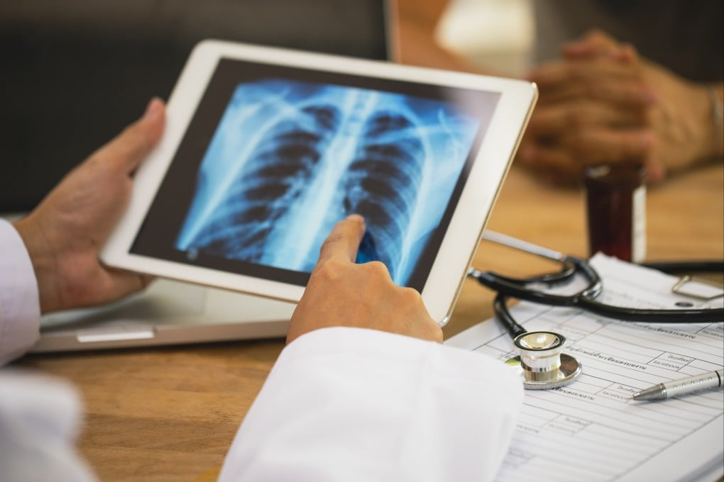 Targeted therapy could turn advanced lung cancer into chronic illness ...