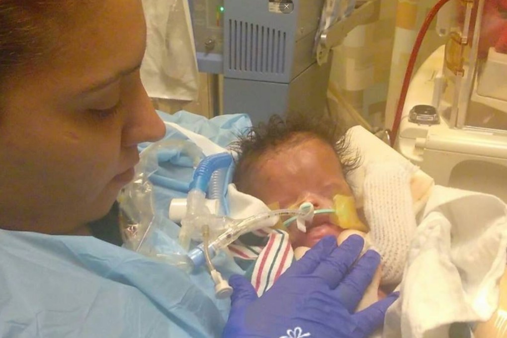 Baby Born With No Skin