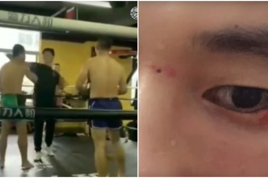 Kung fu ‘master’ gouges Chinese kick-boxer’s eye in cheap shot after ...