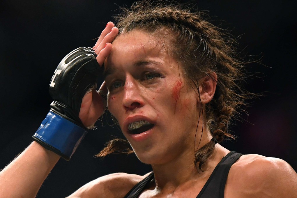 Athlete Facial Hematoma UFC Star Joanna Jedrzejczyk Shows Off