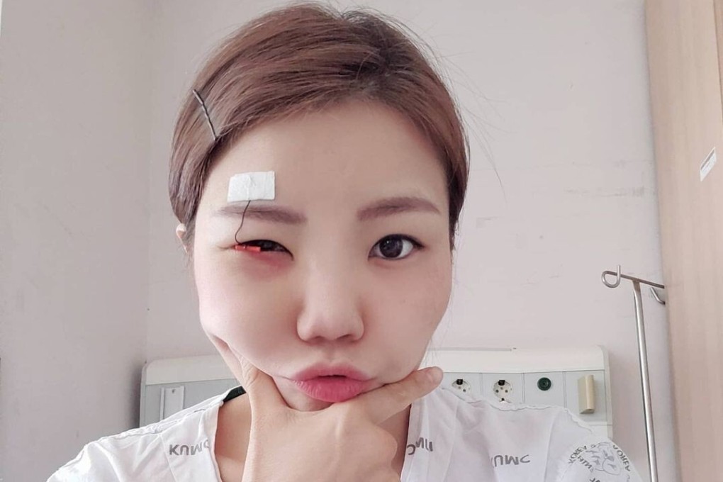 jiyeon before surgery