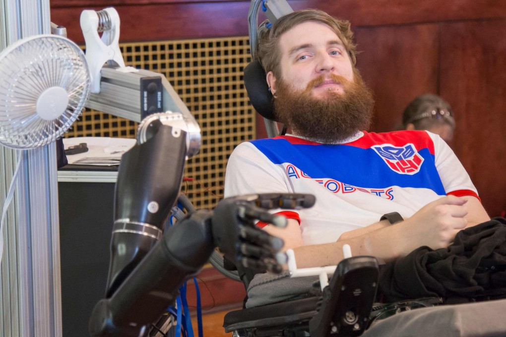 Brain-controlled robotic arm gives paralysed man sense of touch | South ...
