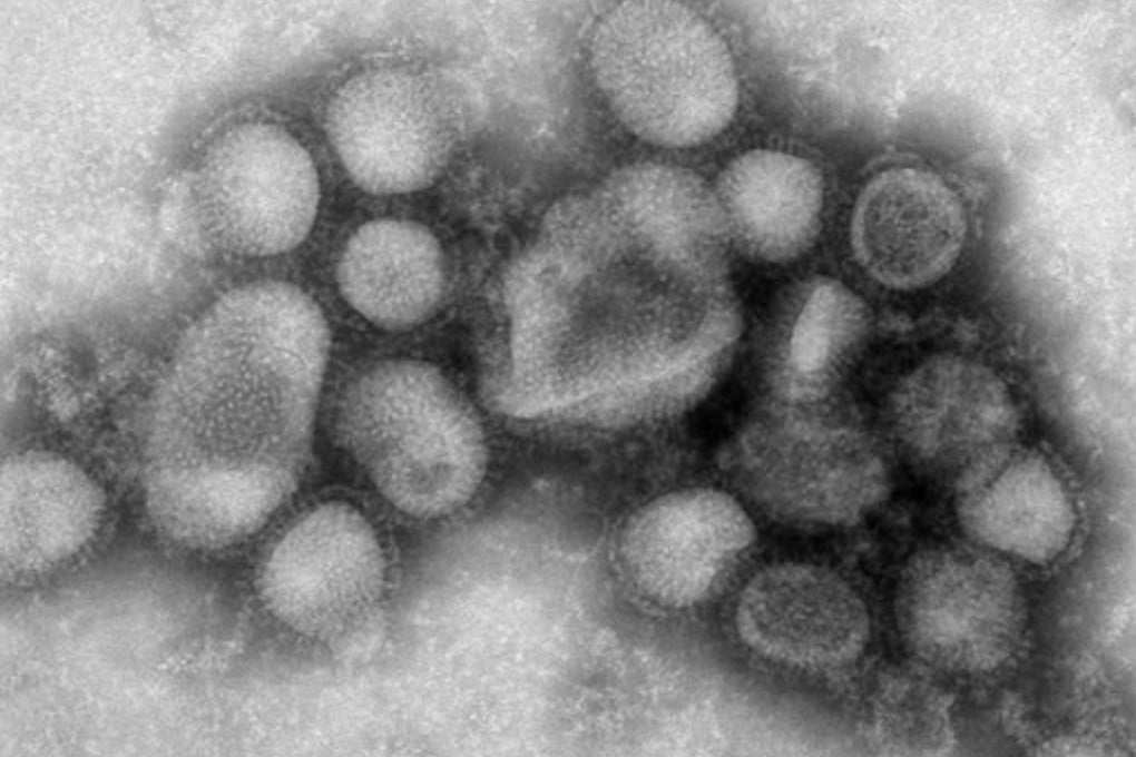 electron microscope flu virus