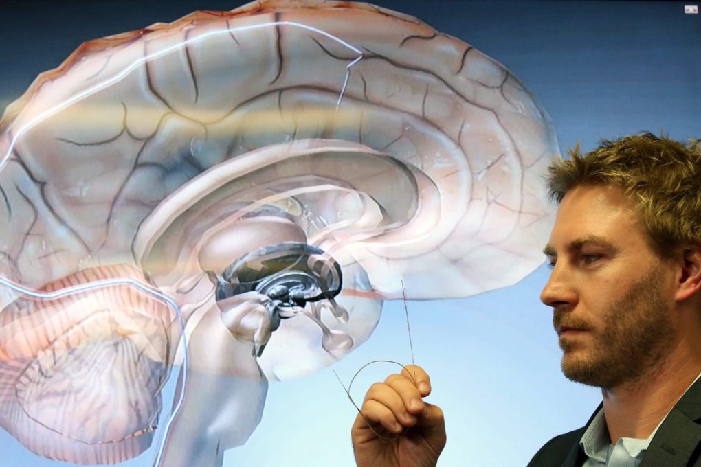 Australian scientists present ‘bionic spinal cord’ designed to help ...
