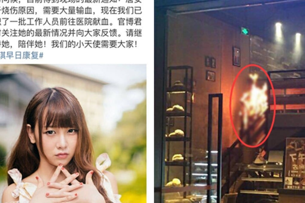 Tanq Anqi, member of Shanghai girl idol band, suffers severe burns ...
