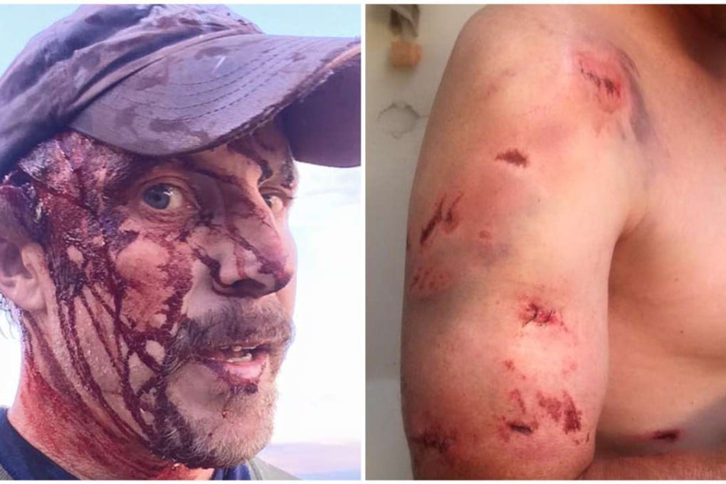 drop bear attack survivors