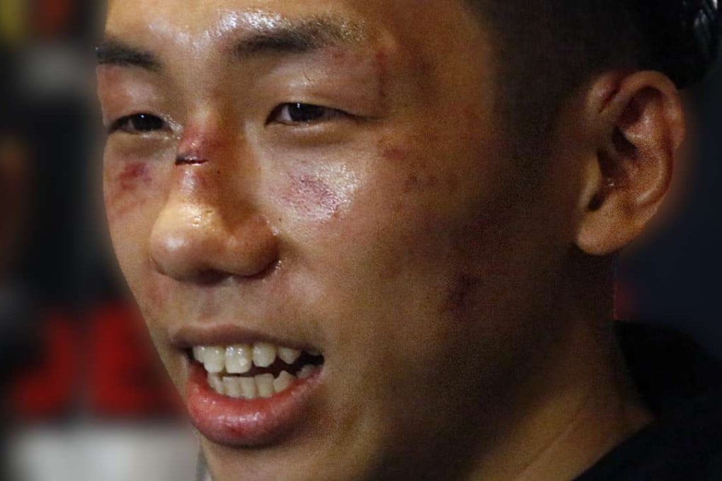 I almost blacked out ... I had to continue: Rex Tso describes struggle ...