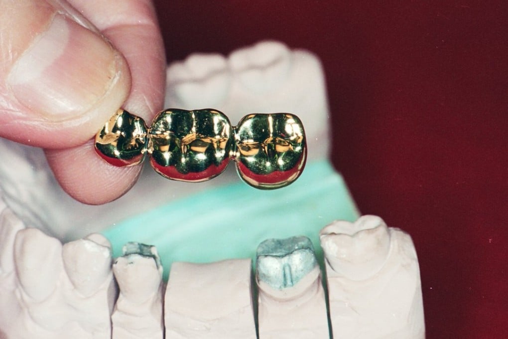 Then & Now | Remember the shrewd gold-toothed amahs? Dentistry in Hong ...