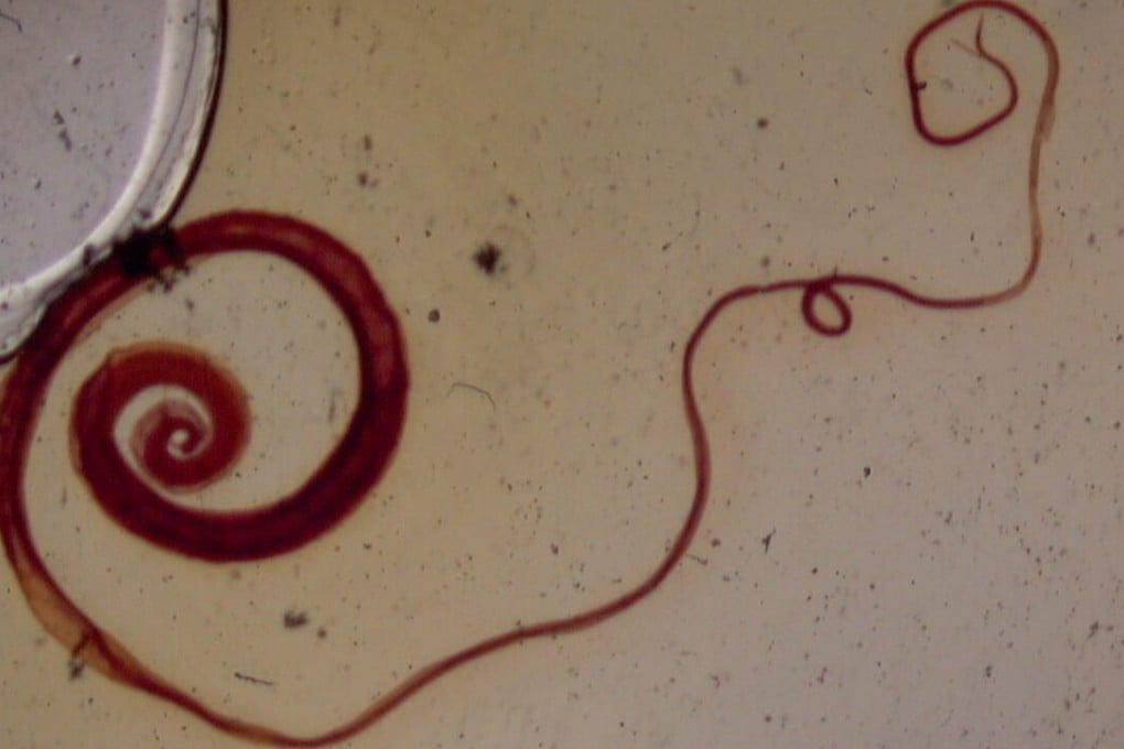 parasitic roundworms examples