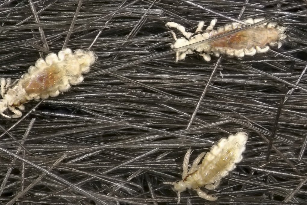 head lice bugs