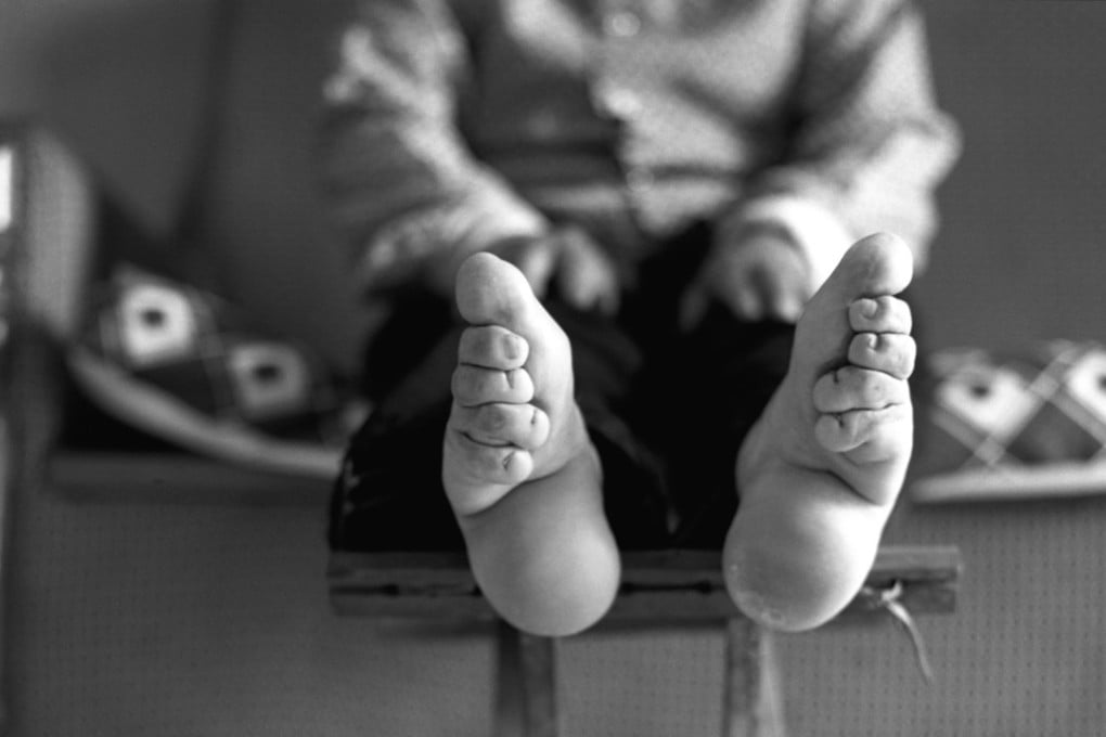 do chinese still do foot binding