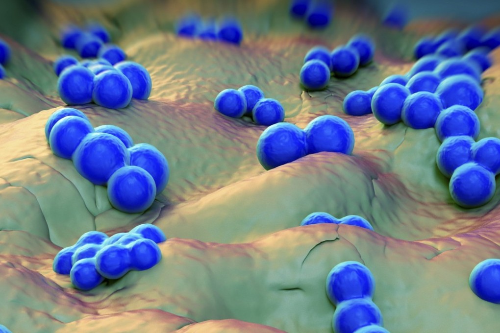Smartphone tests for infections could be the next step in global fight ...