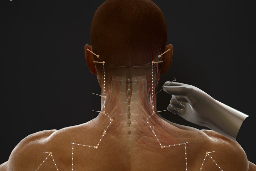 Chinese Acupuncture Points