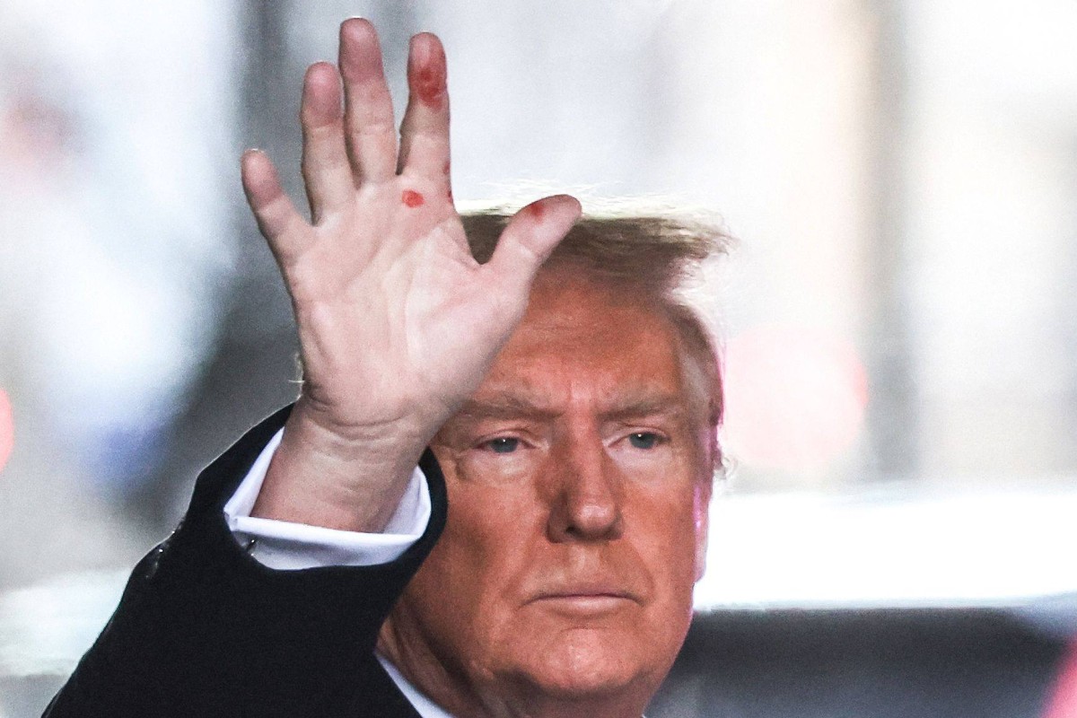 What are the mysterious red marks on Donald Trump’s hand? Photos of ...