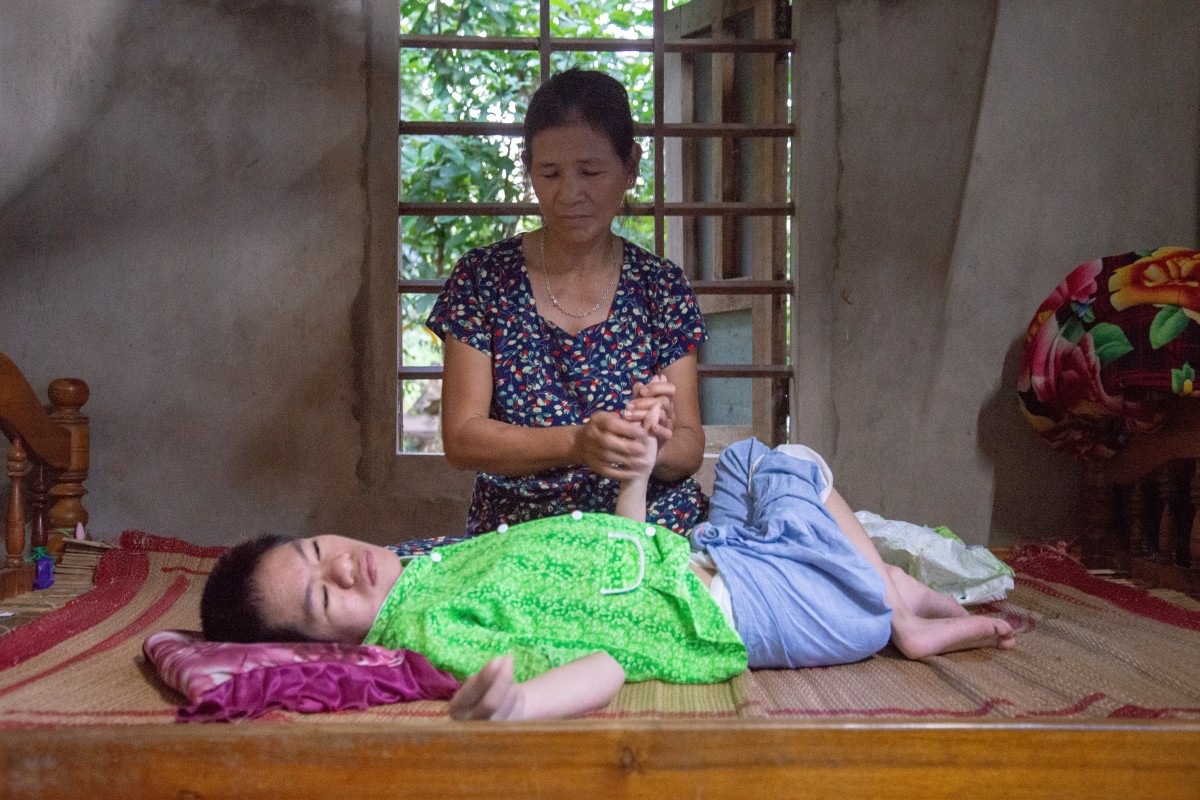 Vietnam war: 44 years on, birth defects from America’s Agent Orange are ...