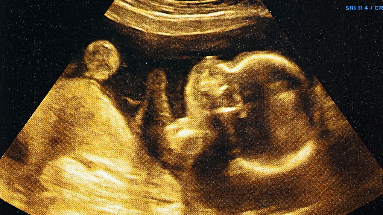 China-led team replicates human embryo ‘invasion’ of the womb for the ...