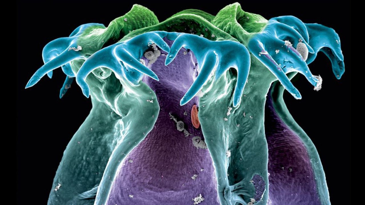 tapeworm under microscope face