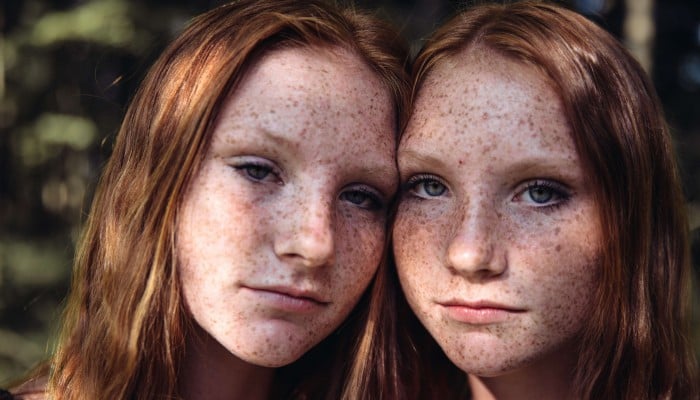 In Pictures: Seeing double at Twins Days Festival | South China Morning ...