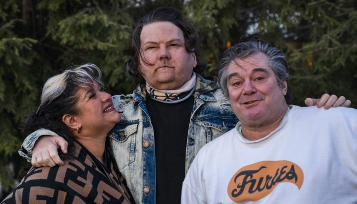 Joe DiMeo gets world’s first double hand and face transplant | South ...