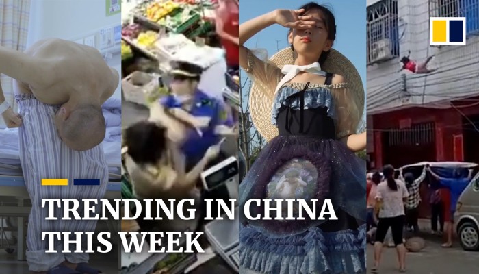 Trending in China: ‘Folded man’ finally stands up straight after 28 ...