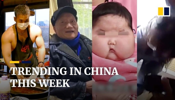 Trending in China: Steroid cream gives baby protruding and hairy cheeks ...