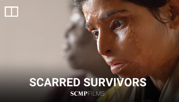 Scarred survivors: India’s women rise up after acid attacks | South ...